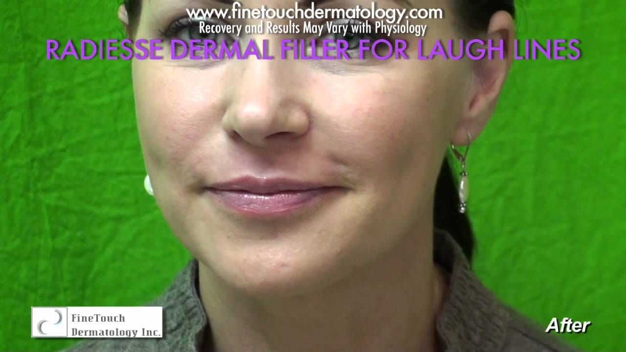 Los Angeles Laugh Lines Info